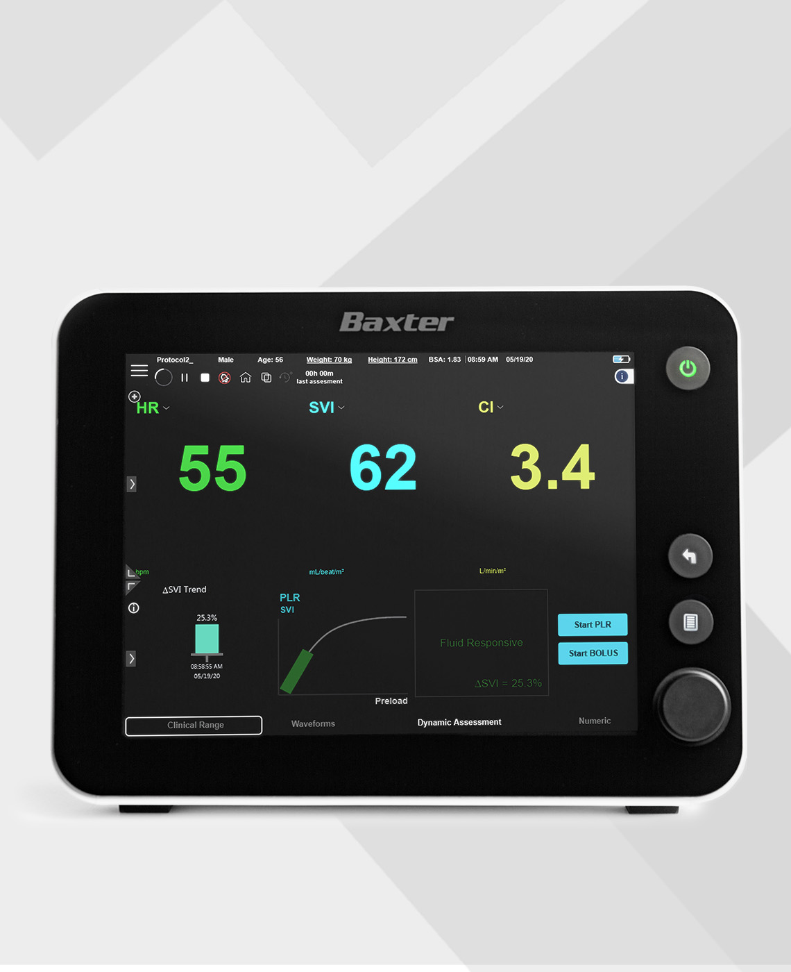 Starling Fluid Management Monitoring System