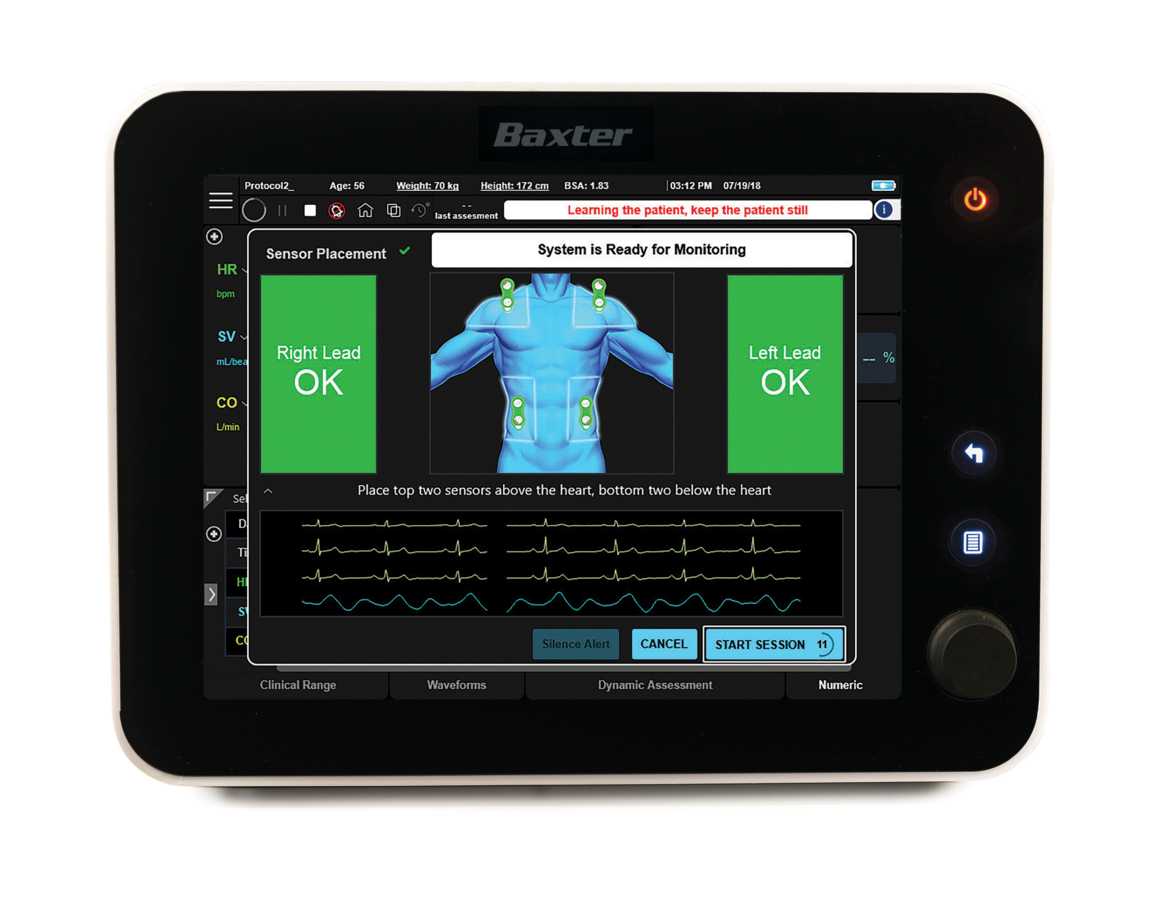 Starling System Overview
